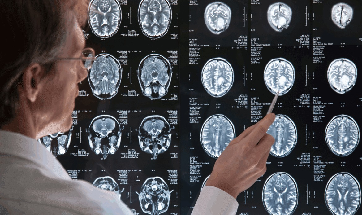 Bloomfield Brain Injury Lawyer– 5-Star Injury Attorney Serving CT